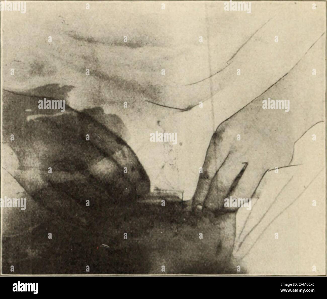 Wisconsin medical recorder . FIGURE V Fig. 5. The edge of the pectineal ...