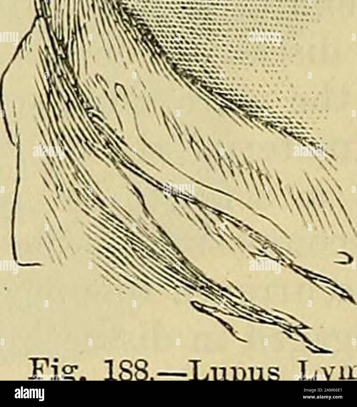 A system of surgery . ls of some septic alkaloid(ptomaine), derived ...