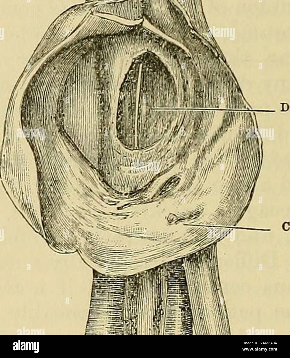 A system of surgery . :*mm^ u c Fig. 182.—Mr. Pembertons case of ...