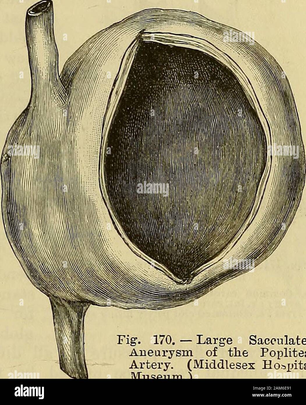 Sacculated hi-res stock photography and images - Alamy