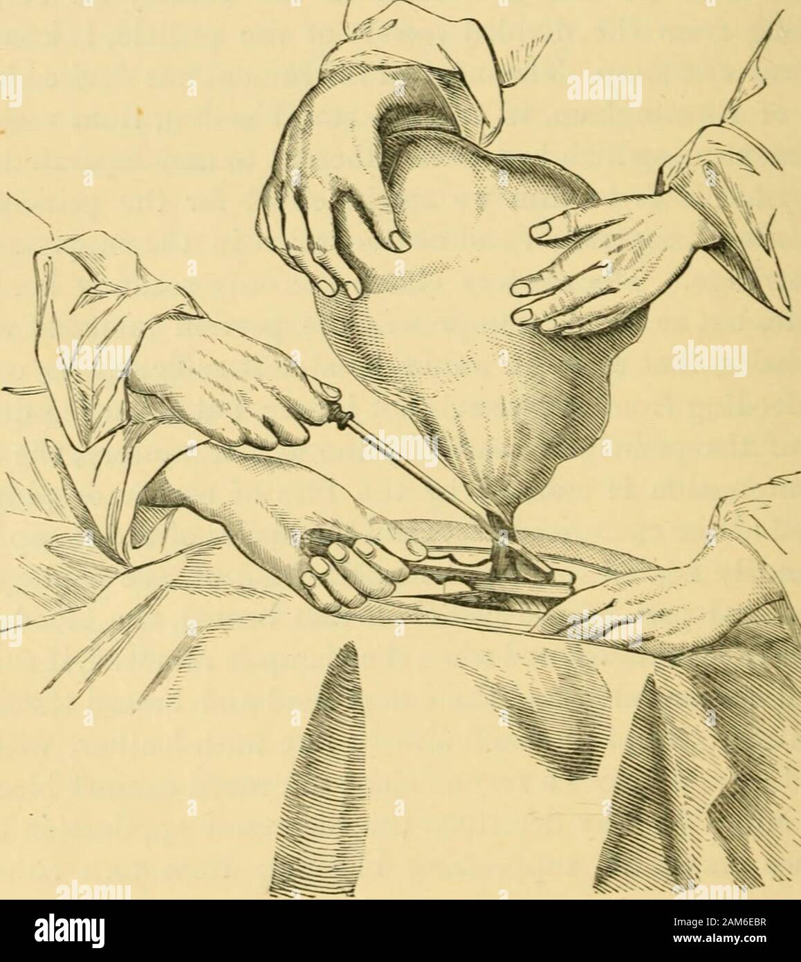Cautery irons hi-res stock photography and images - Alamy