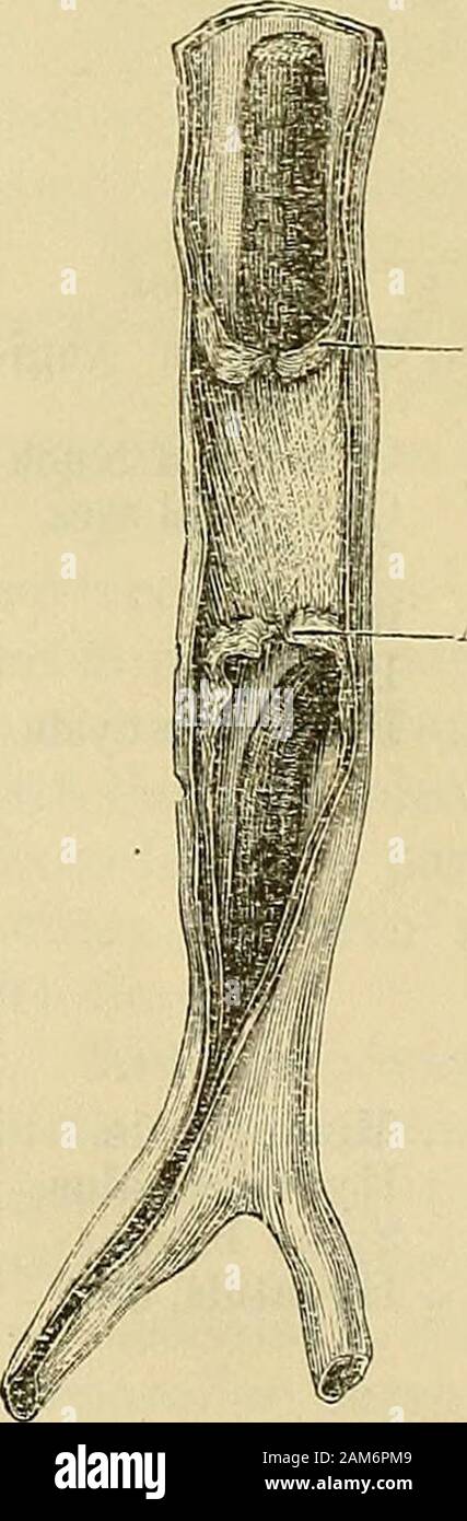 Blunt force weapons hi-res stock photography and images - Alamy