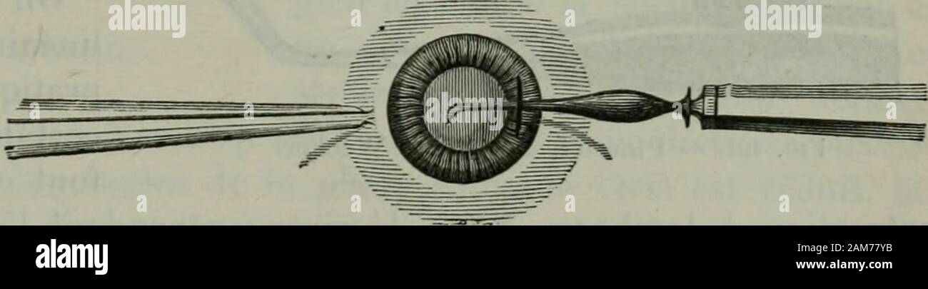 Capsule molle hi-res stock photography and images - Alamy