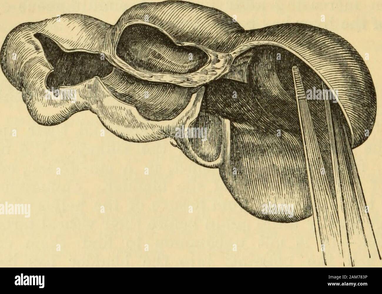 Manual of pathological anatomy . uch a division is often seen in the ...