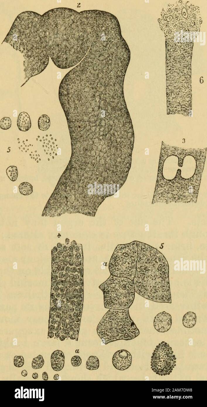 Enlarged red spots hi-res stock photography and images - Alamy