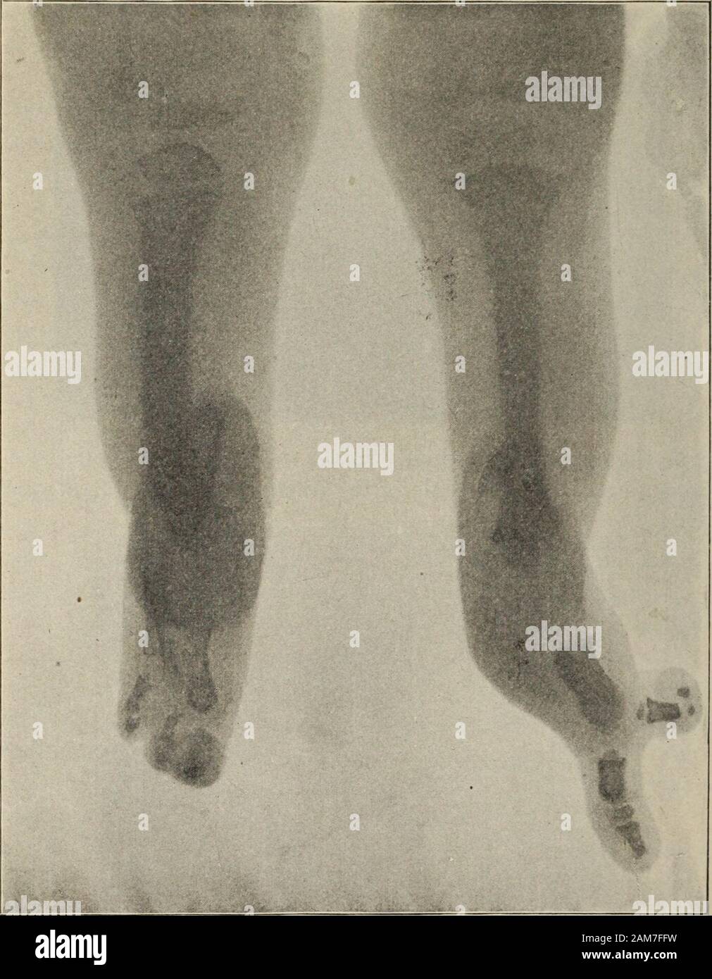 Giant middle finger hi-res stock photography and images - Alamy