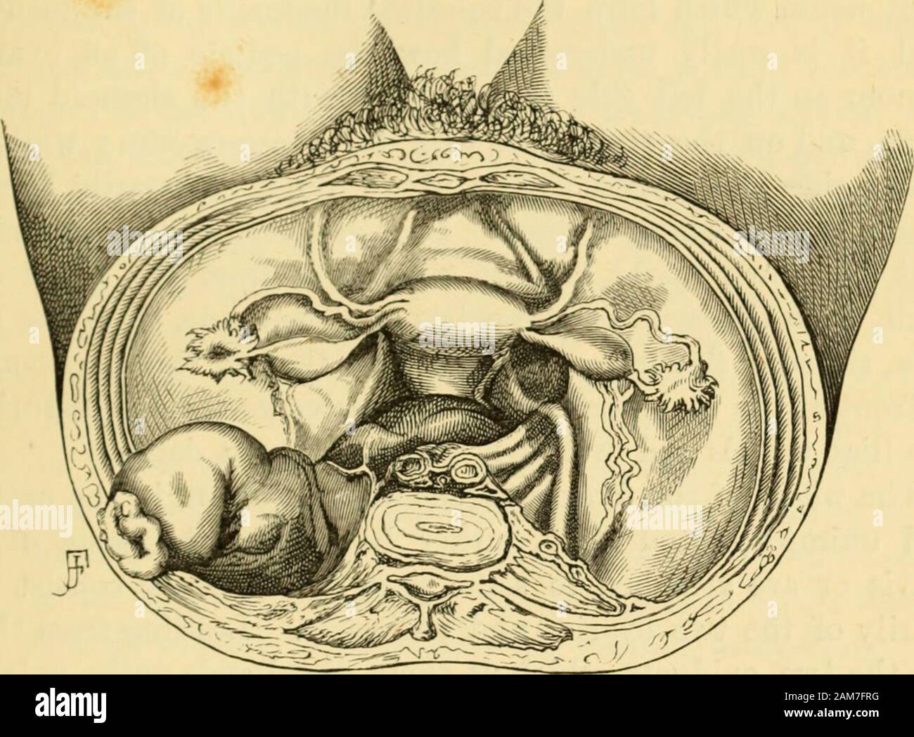 Ovaries diagram hi-res stock photography and images - Alamy