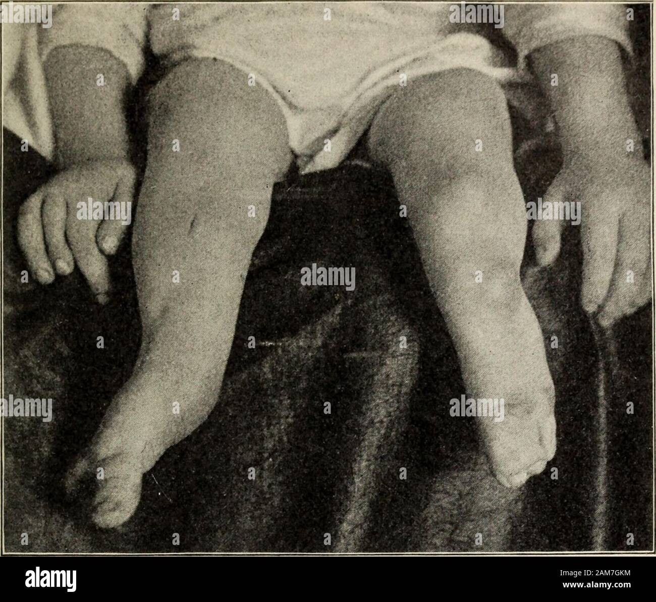 The Hahnemannian monthly . , although of no interestfrom a surgical ...