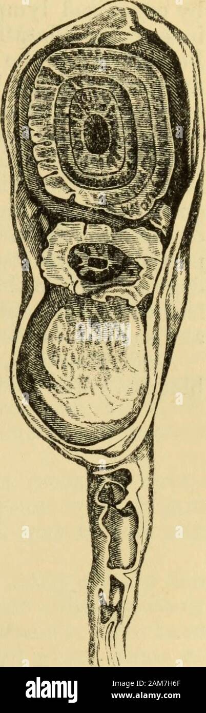 Distoma hi-res stock photography and images - Alamy