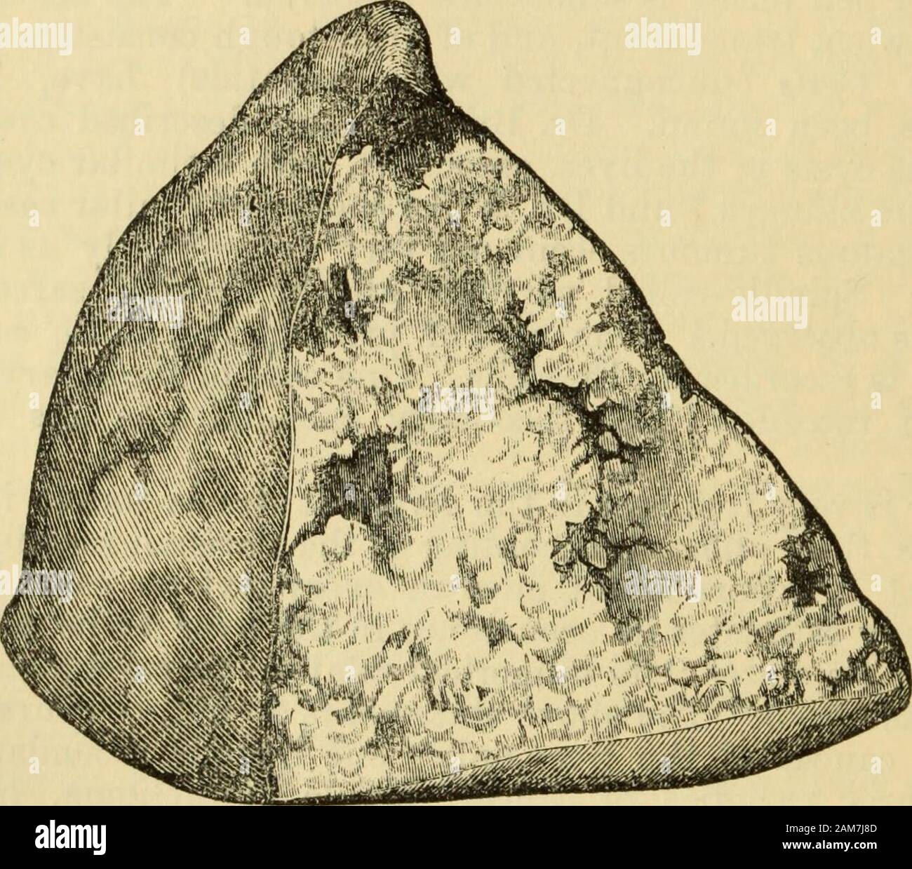 Liver parenchyma hi-res stock photography and images - Alamy