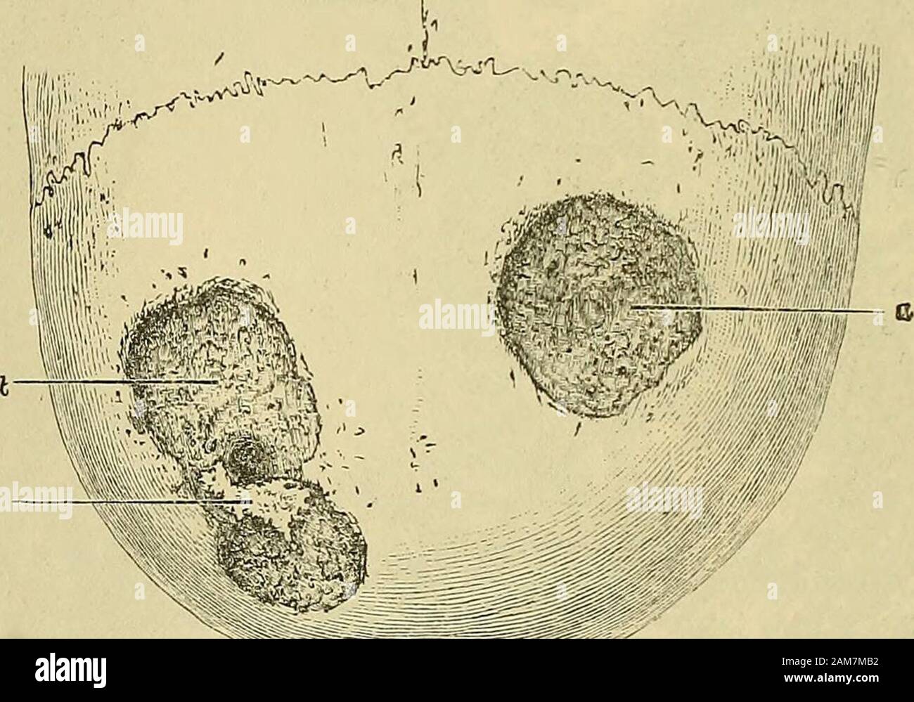 Calvarium hi-res stock photography and images - Alamy