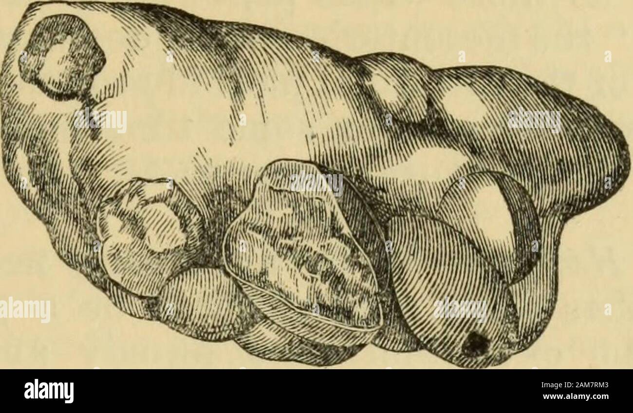 Small intestine cut hi-res stock photography and images - Alamy