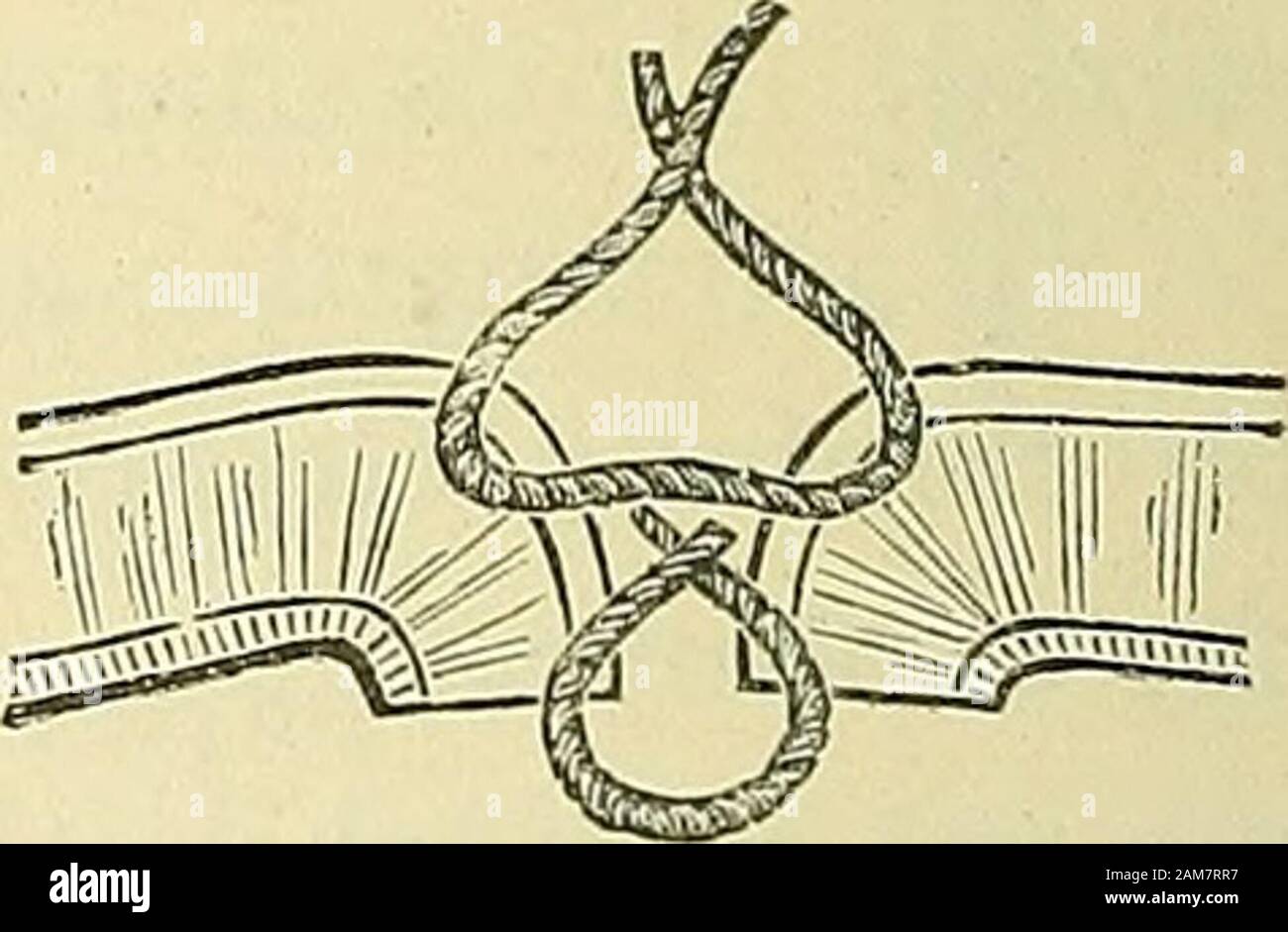 Abdominal surgery . IfedJFig. 35. Lembevts Intestinal Suture. Fig. 36 ...