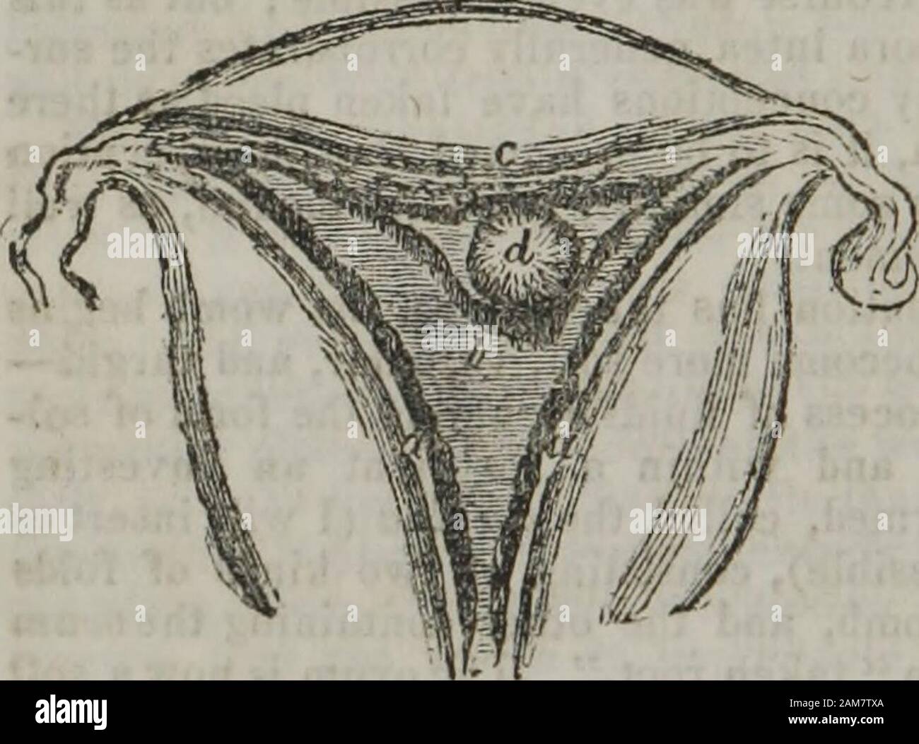 Double uterus hi-res stock photography and images - Alamy