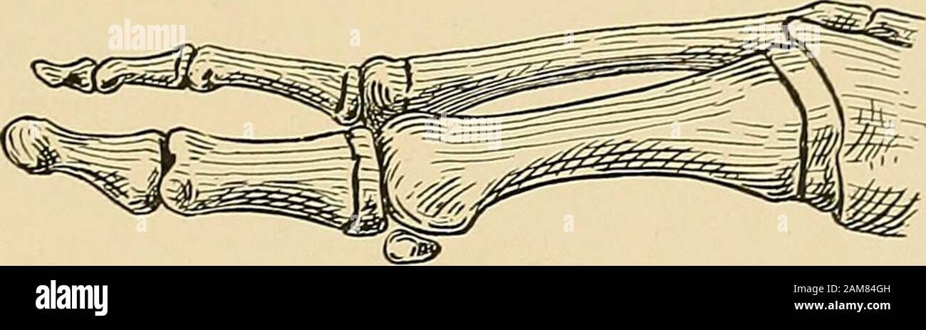 Os calcis hi-res stock photography and images - Alamy