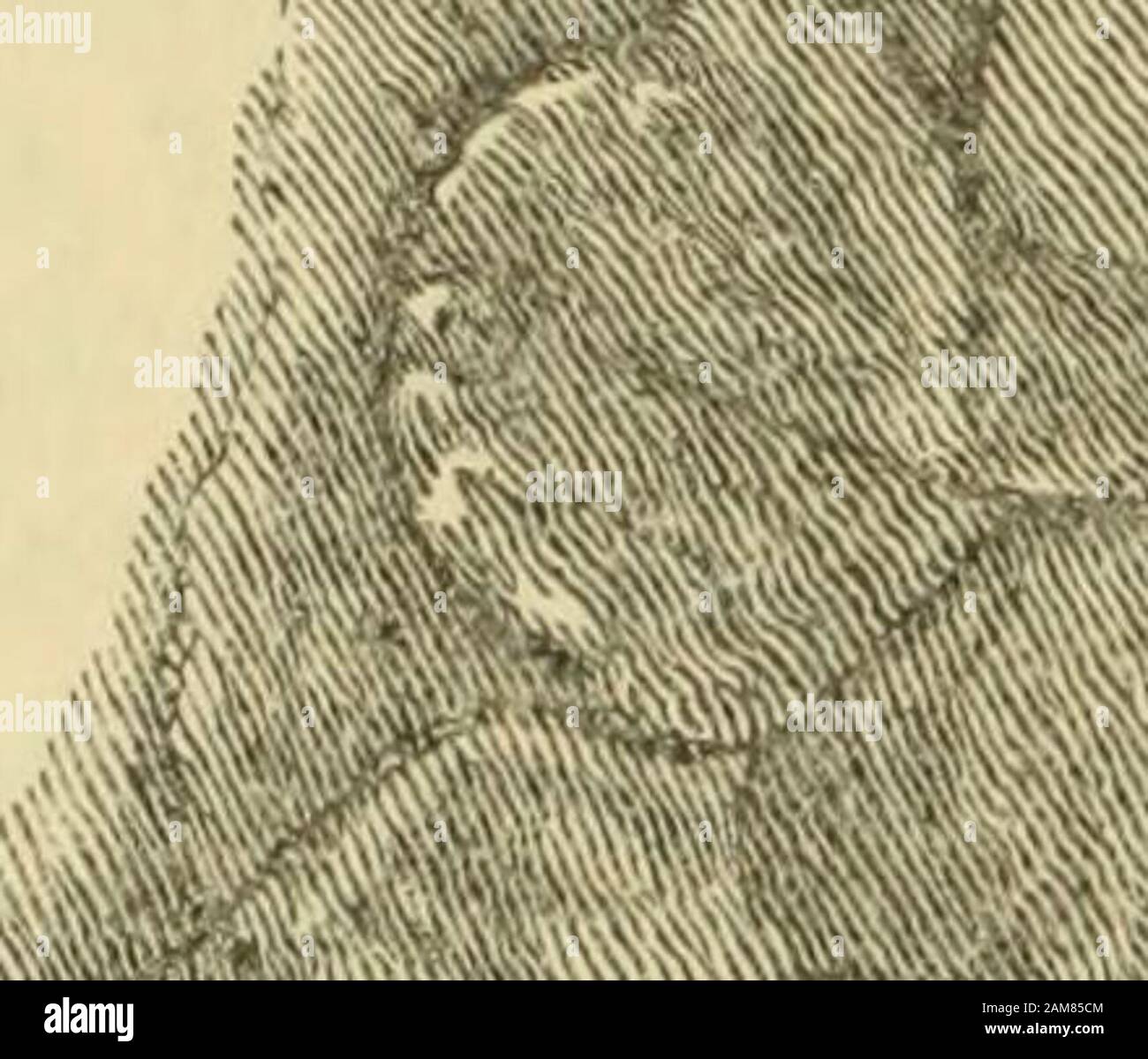 Pneumonic infiltration hi-res stock photography and images - Alamy