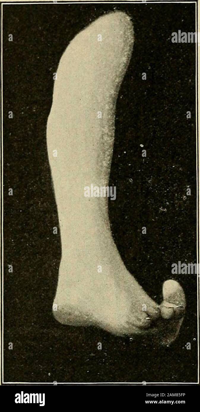 Organic and functional nervous diseases; a text-book of neurology ...
