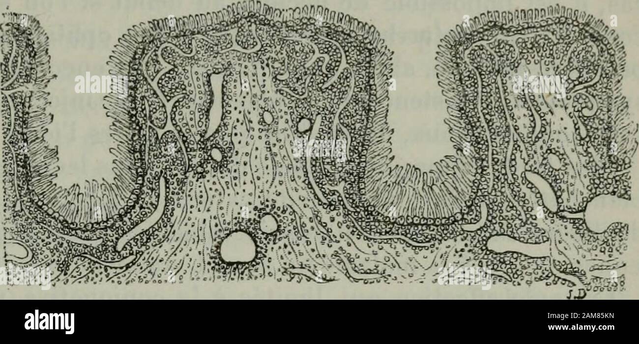 Purulence hi-res stock photography and images - Alamy