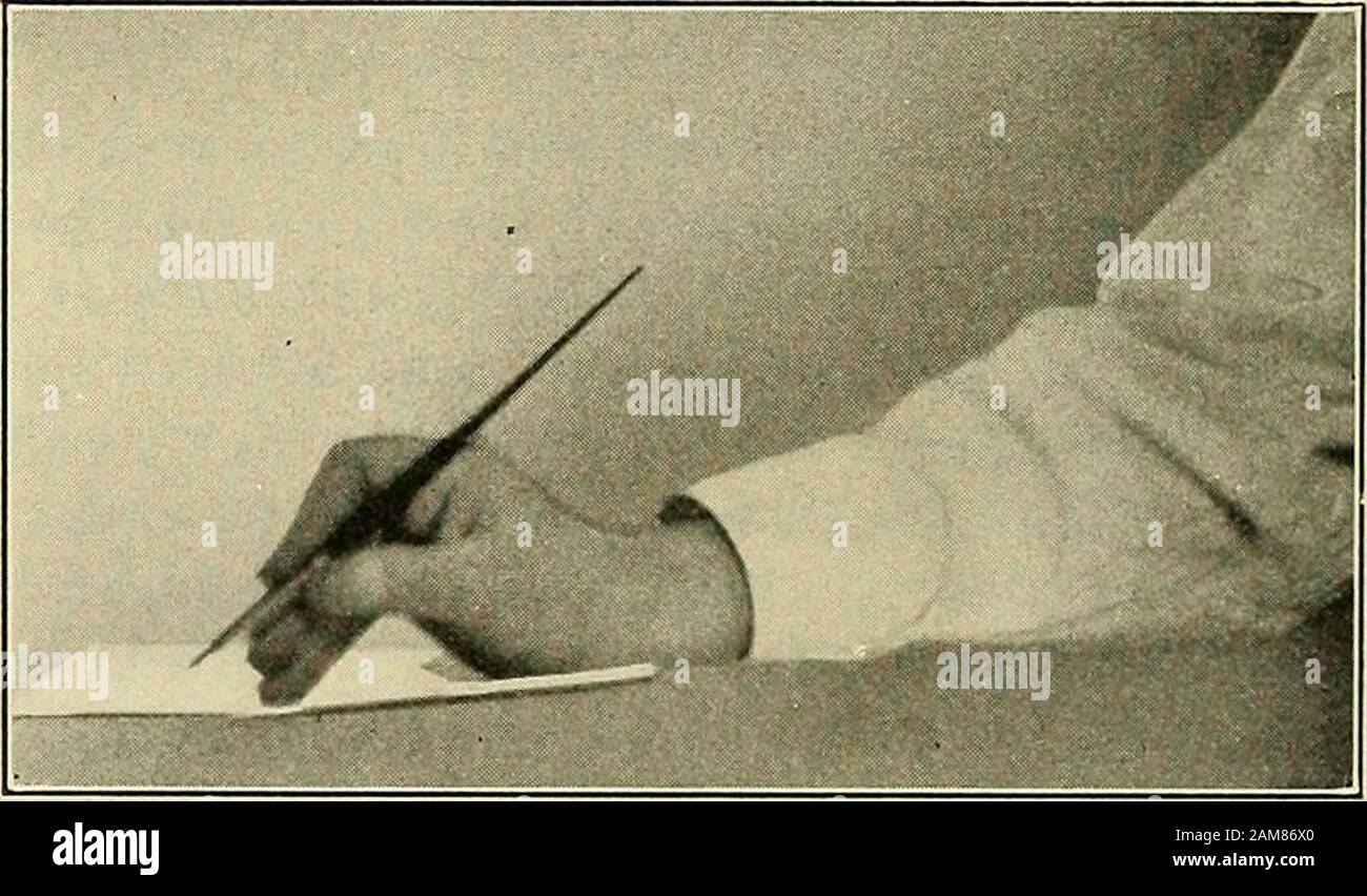 Organic and functional nervous diseases; a text-book of neurology . Fig ...