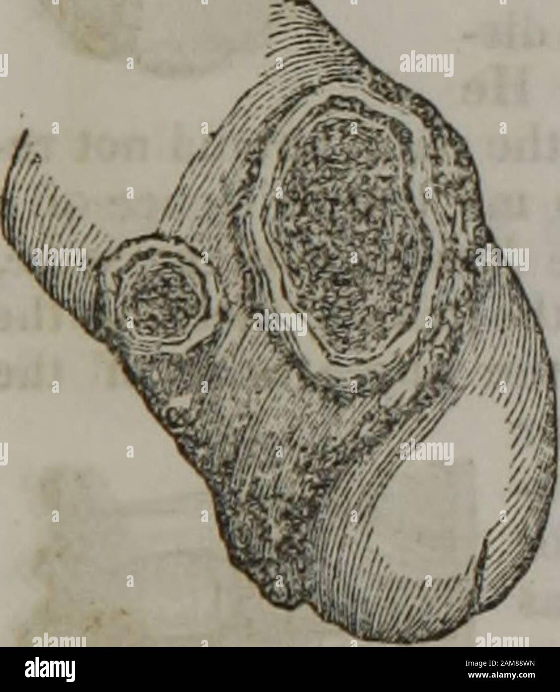 Prepuce hi-res stock photography and images - Alamy