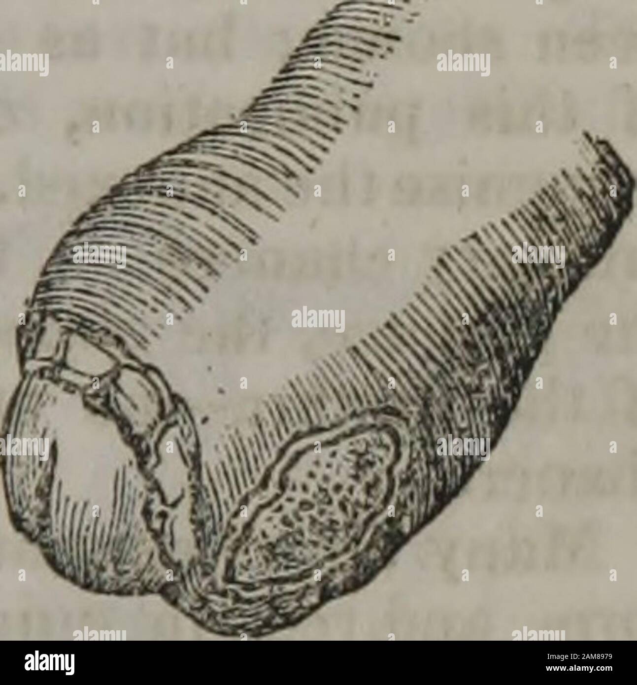 Genital disorders hi-res stock photography and images - Alamy