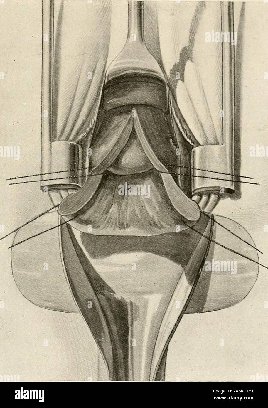 Gynaecology for students and practitioners . at rectangular spatula ...