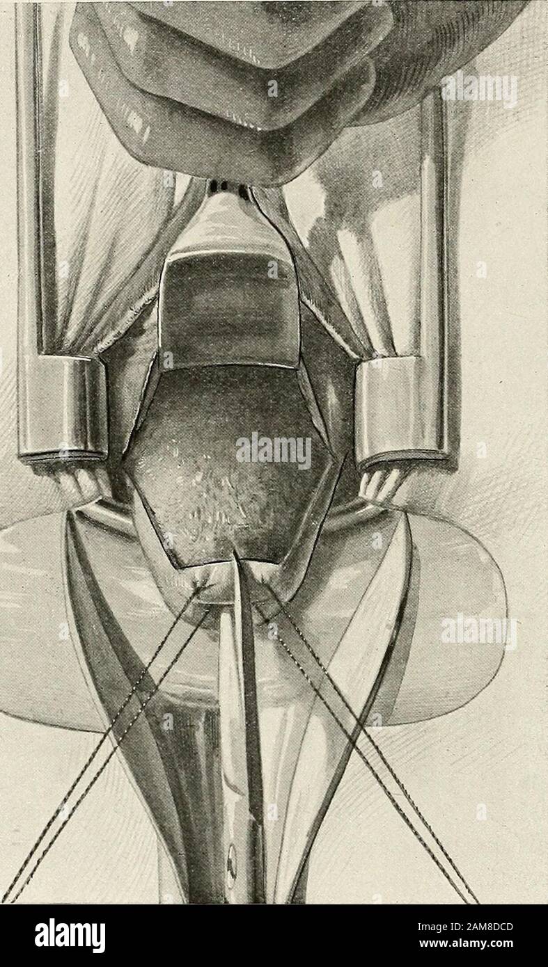Polypi hi-res stock photography and images - Alamy