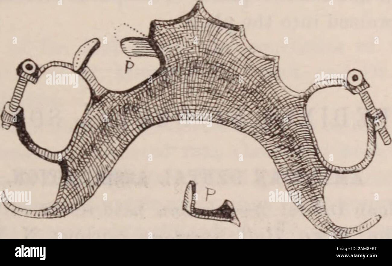 Dental cosmos . to use platinum wire splice anchoredto plates and to ...