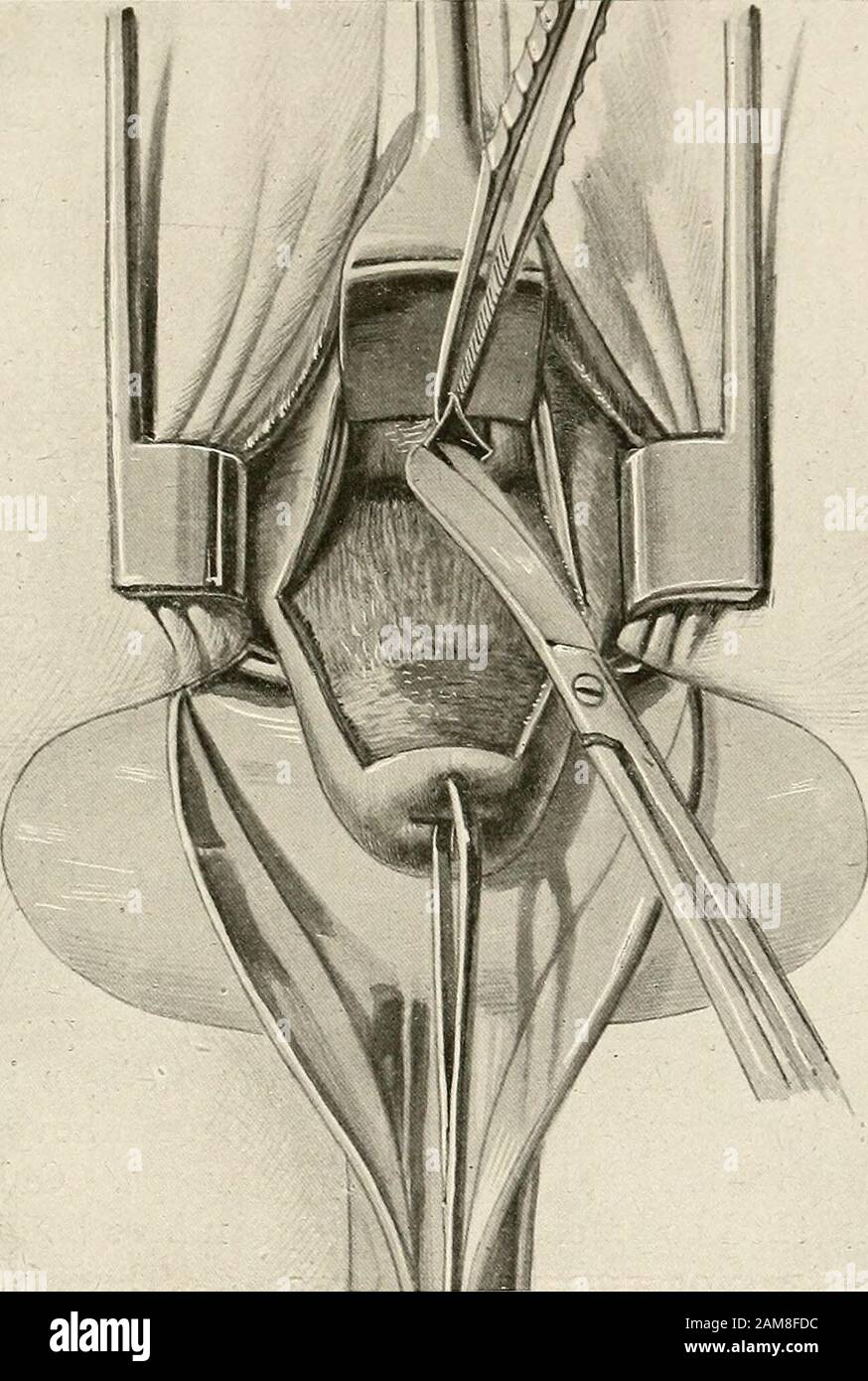 Gynaecology for students and practitioners . -i J^M 1 m »^ i l^^U ii 1 ...