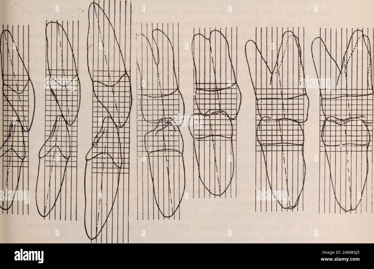 Tooth forms hi-res stock photography and images - Alamy