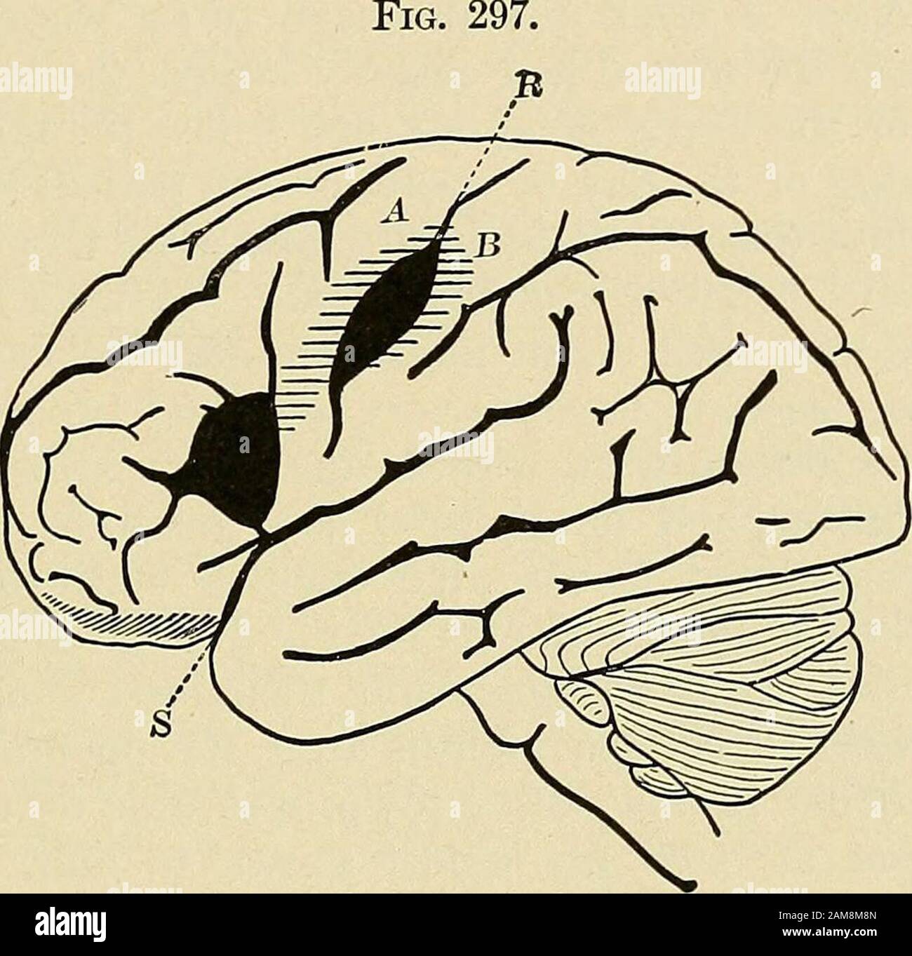 Organic and functional nervous diseases; a text-book of neurology . nd ...