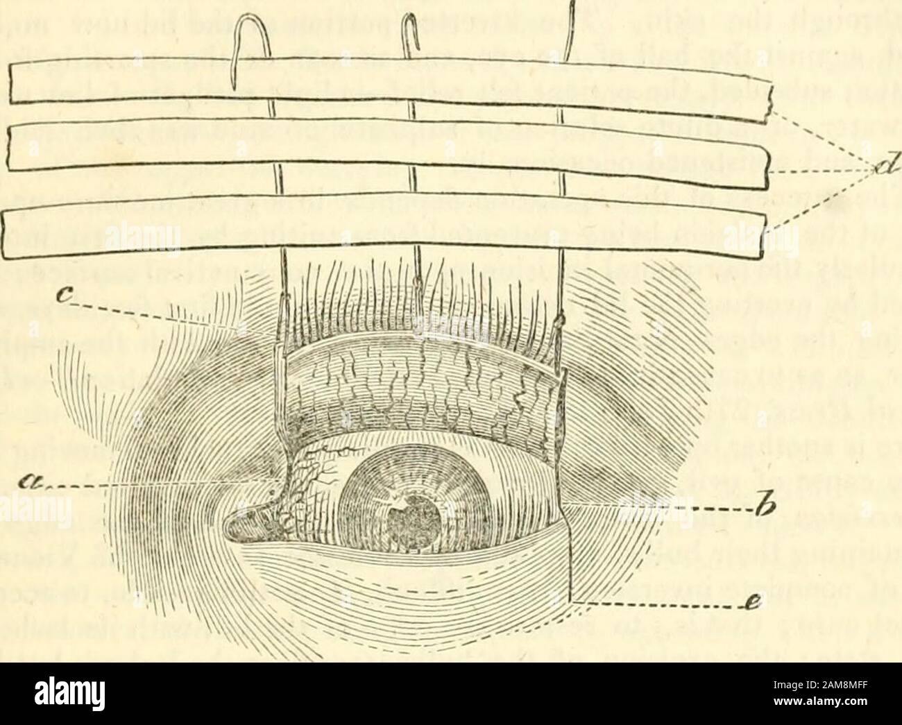 External parts of the eye hi-res stock photography and images - Alamy