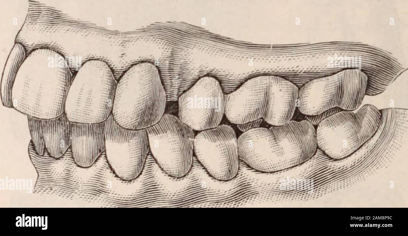 Draw around plate hi-res stock photography and images - Alamy