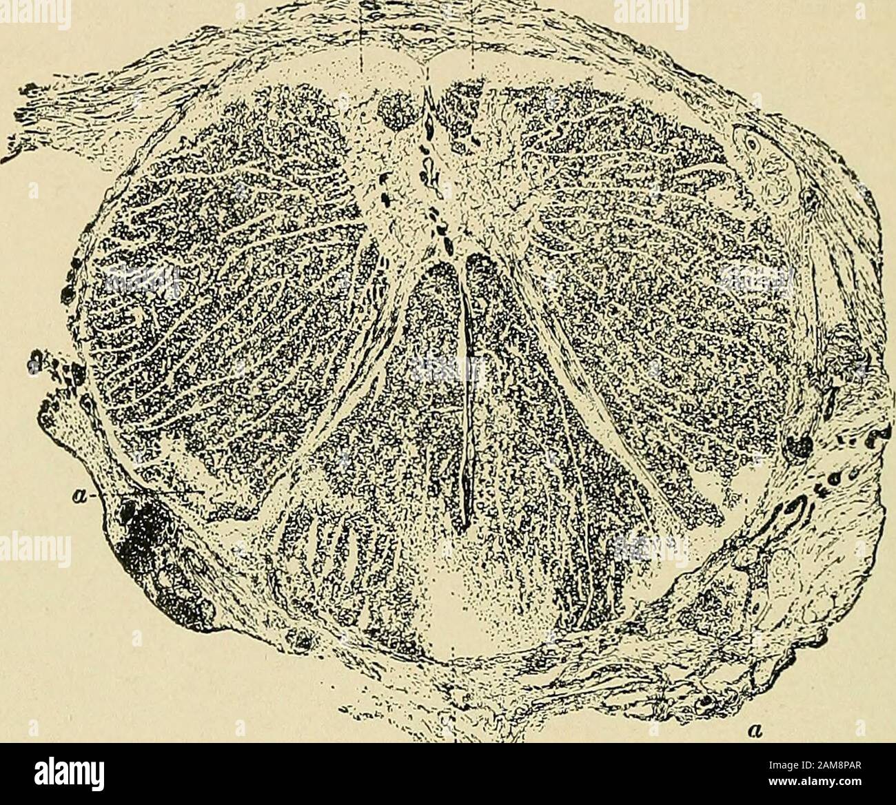 Sixth nerve palsy hi-res stock photography and images - Alamy