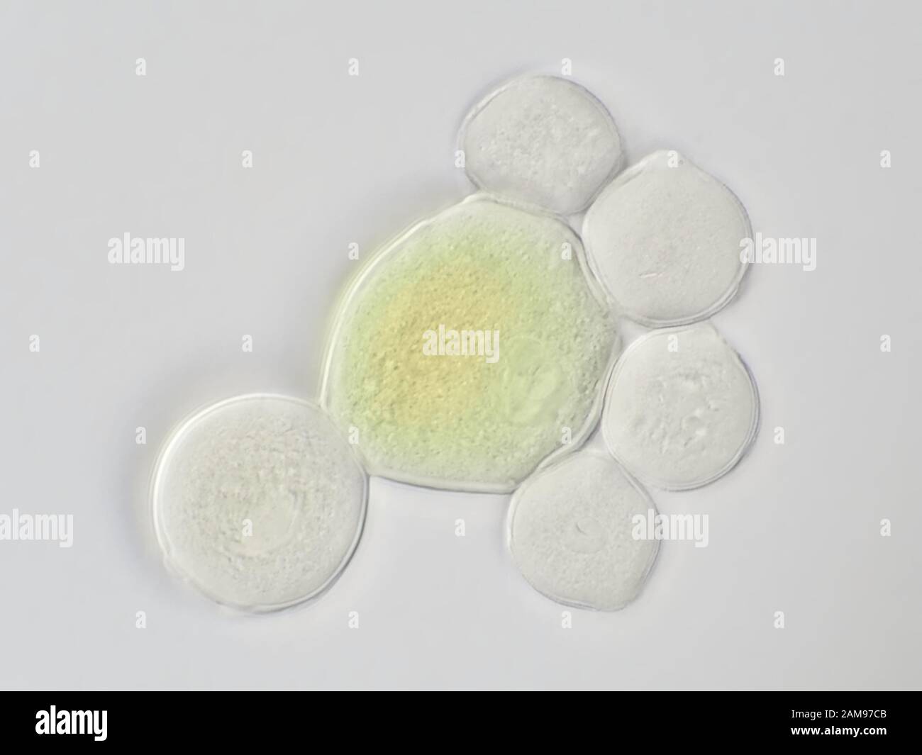 Several pollen grains under the microscope, horizontal field of view is ...