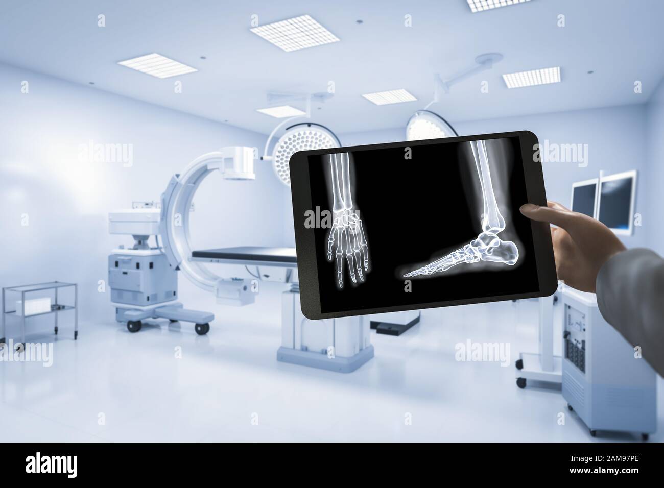 3d mri scan hand hi-res stock photography and images - Alamy