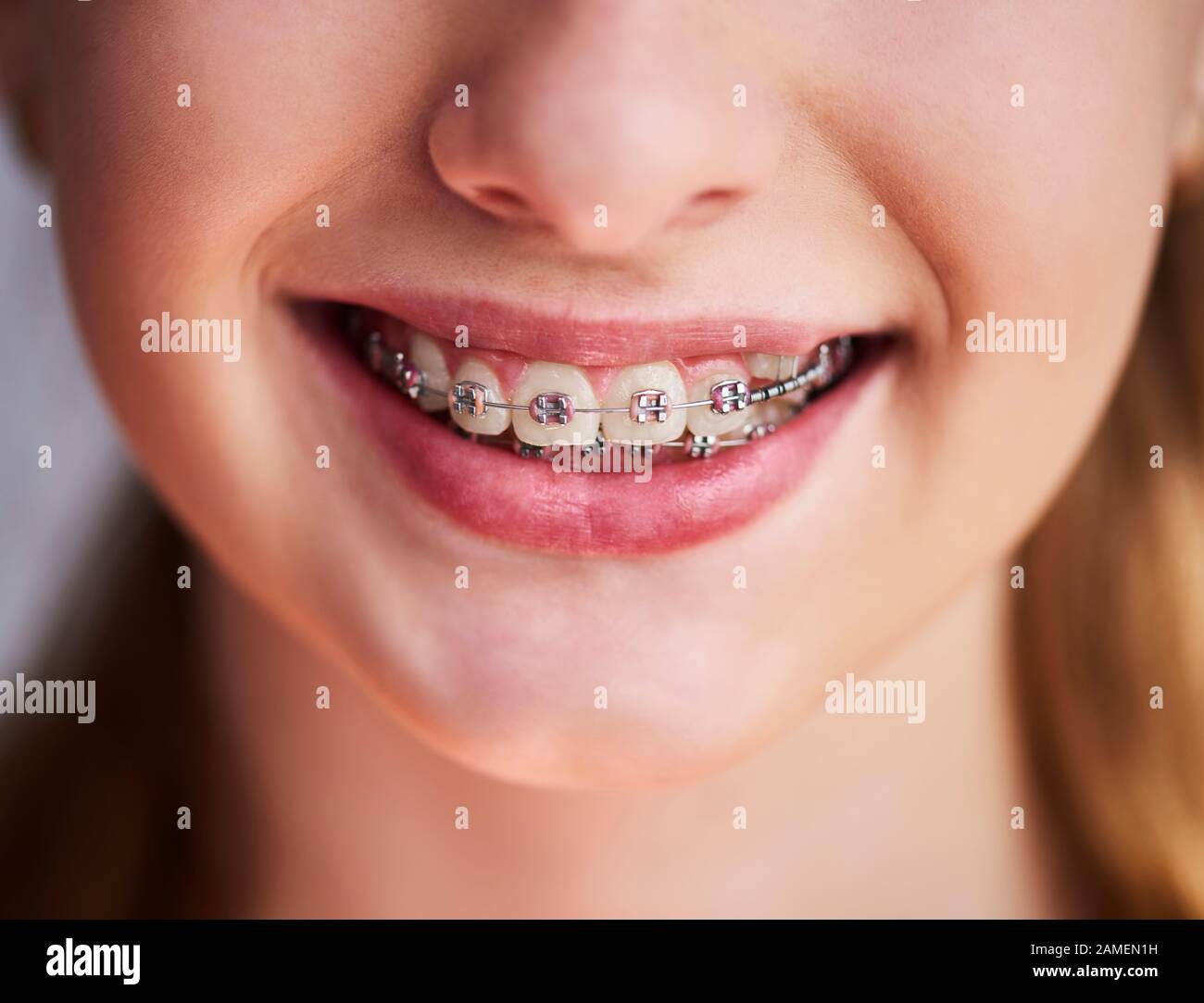 Dental health improvement hi-res stock photography and images - Alamy