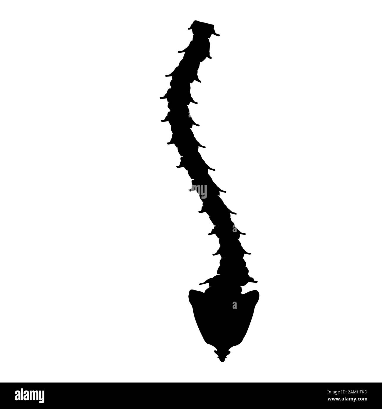 Black and white silhouette icon scoliosis. Spinal curvature, kyphosis ...