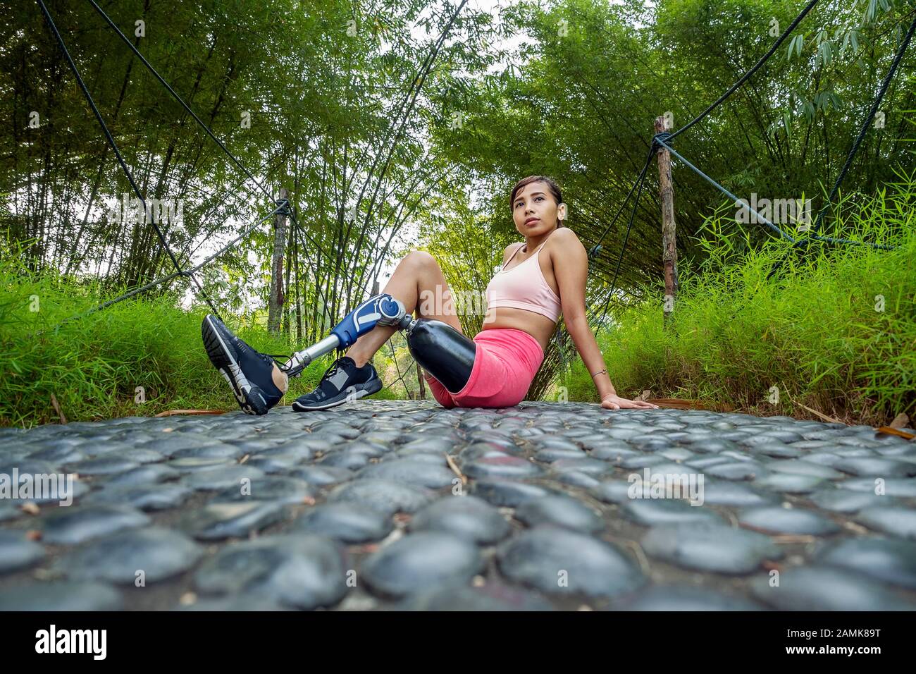 Leg amputated hi-res stock photography and images - Alamy