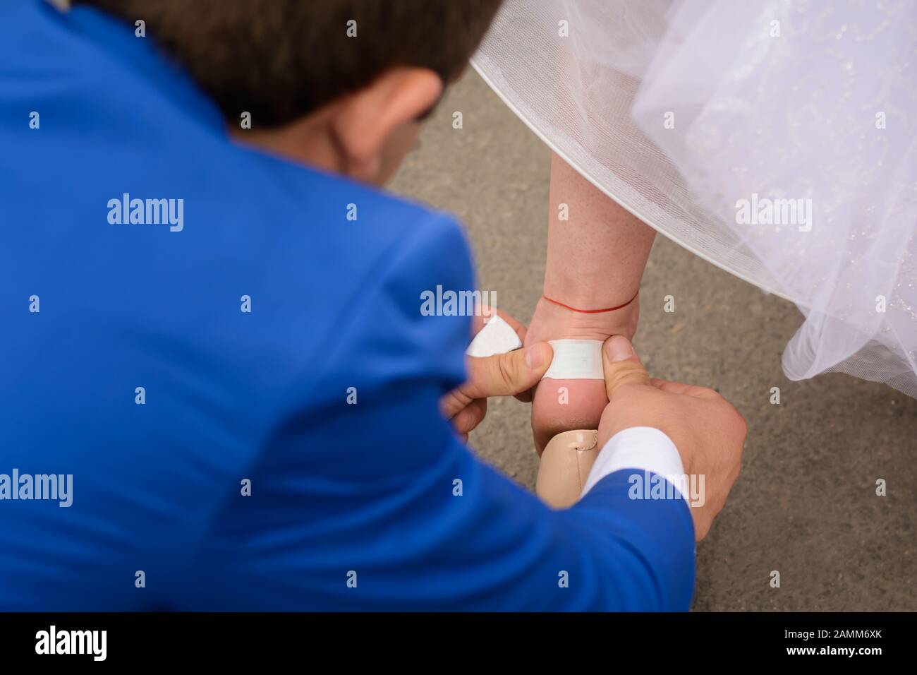Calluses hi-res stock photography and images - Alamy