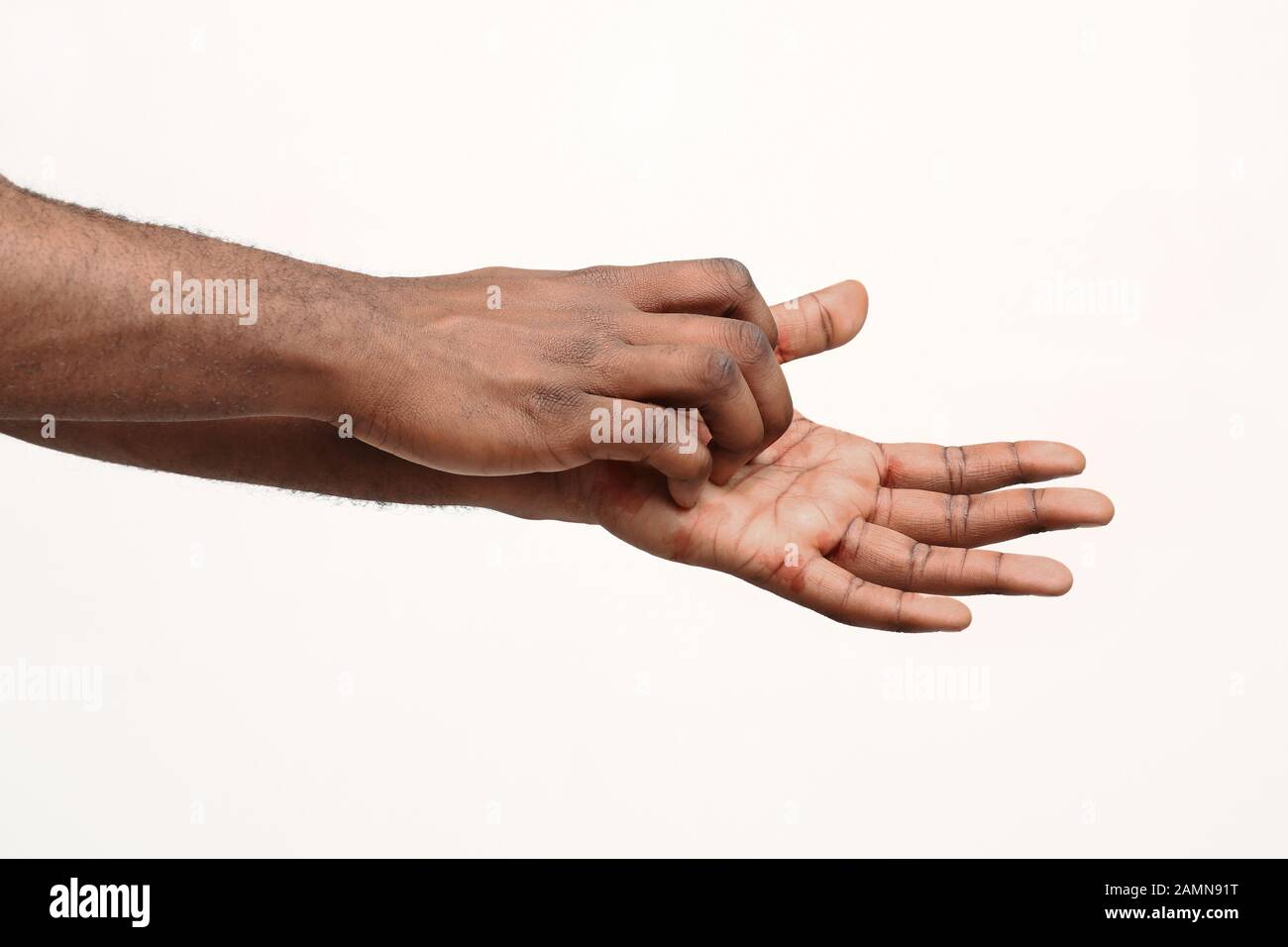 Black man scratching itch on his hand Stock Photo - Alamy