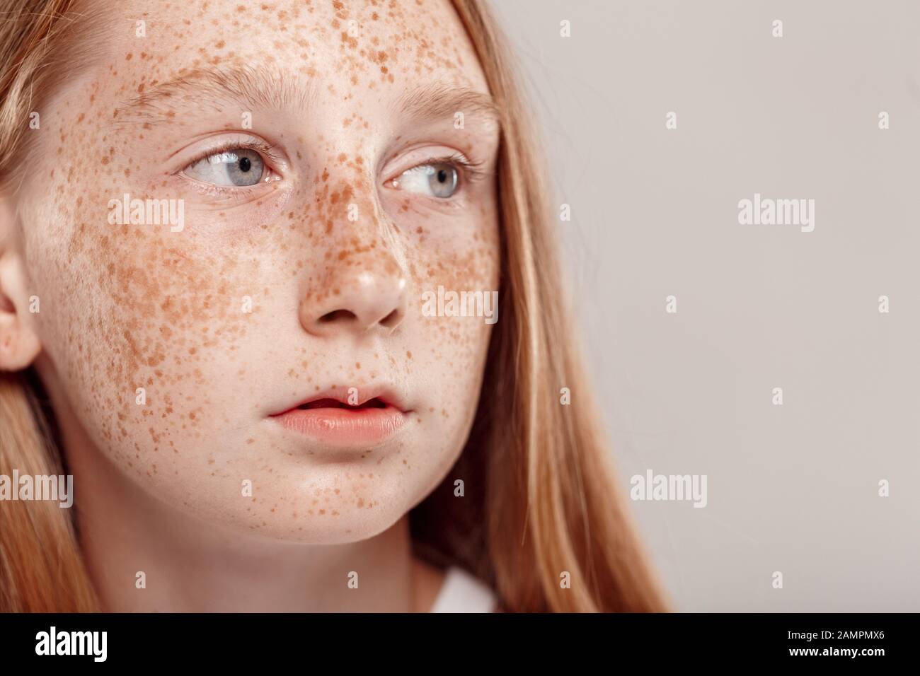 Inclusive Beauty Girl With Freckles Standing Isolated On Grey Looking