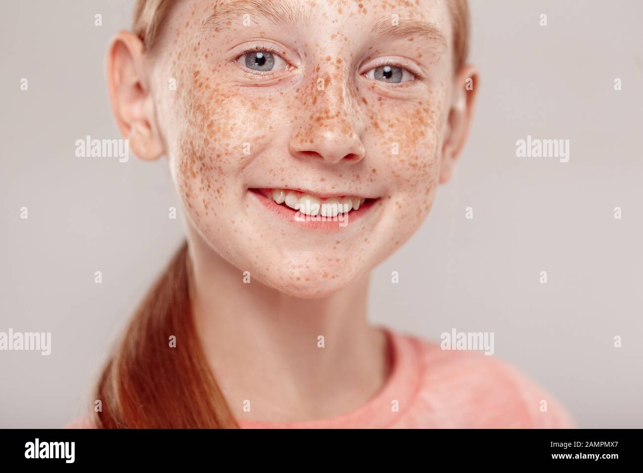 Inclusive Beauty. Girl with freckles standing isolated on grey smiling ...
