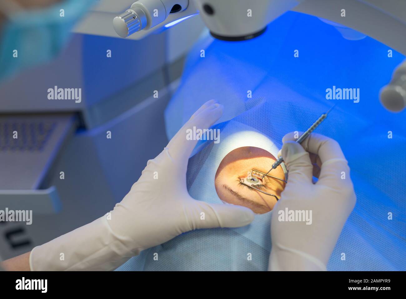 A close-up of the hands of an ophthalmologist surgeon looking through a ...