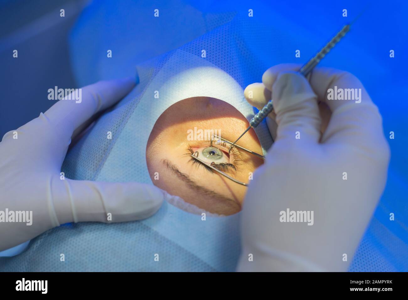 A close-up of the hands of an ophthalmologist surgeon looking through a ...