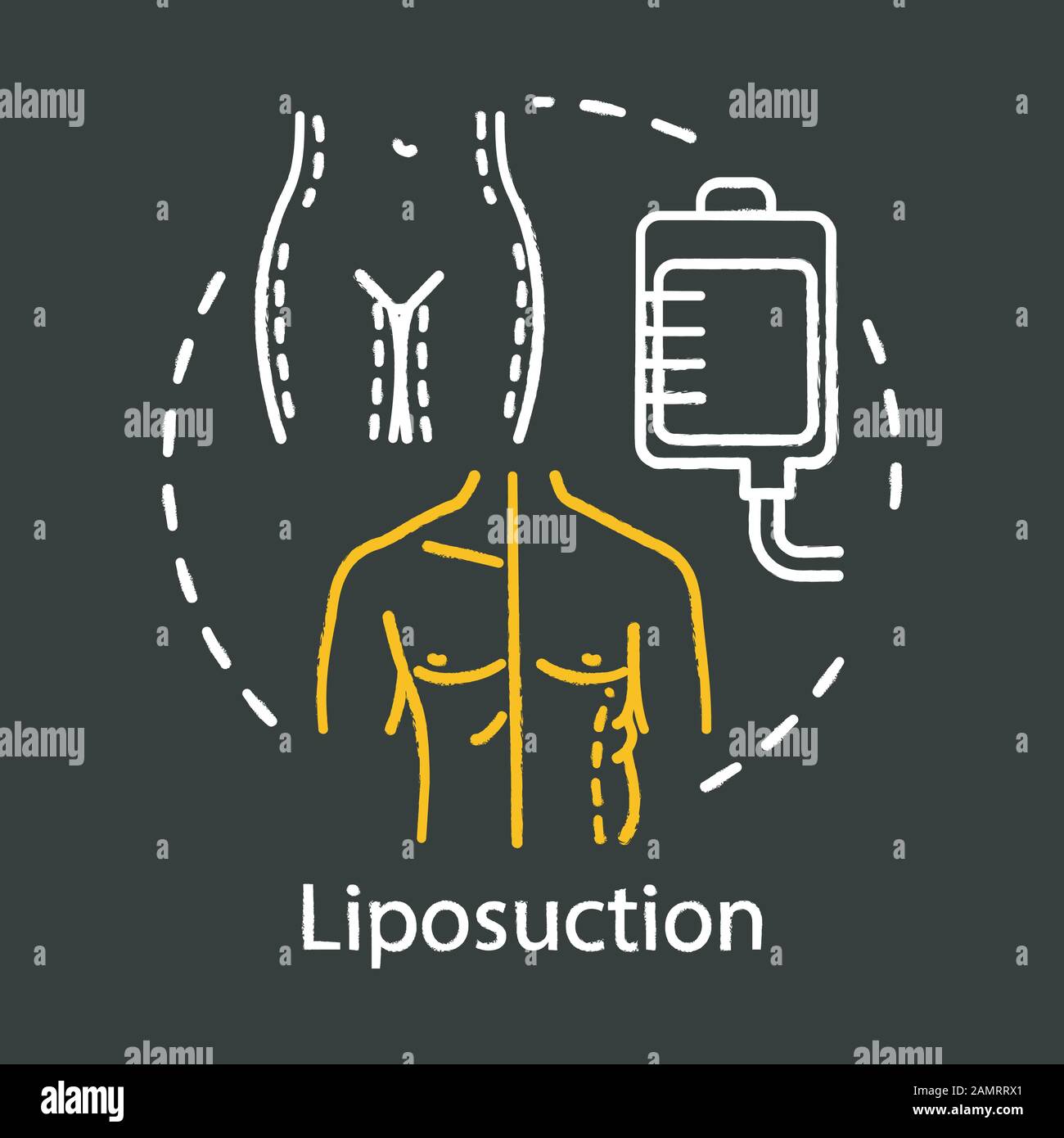 Liposuction chalk icon. Fat suction. Slim body silhouette. Plastic ...