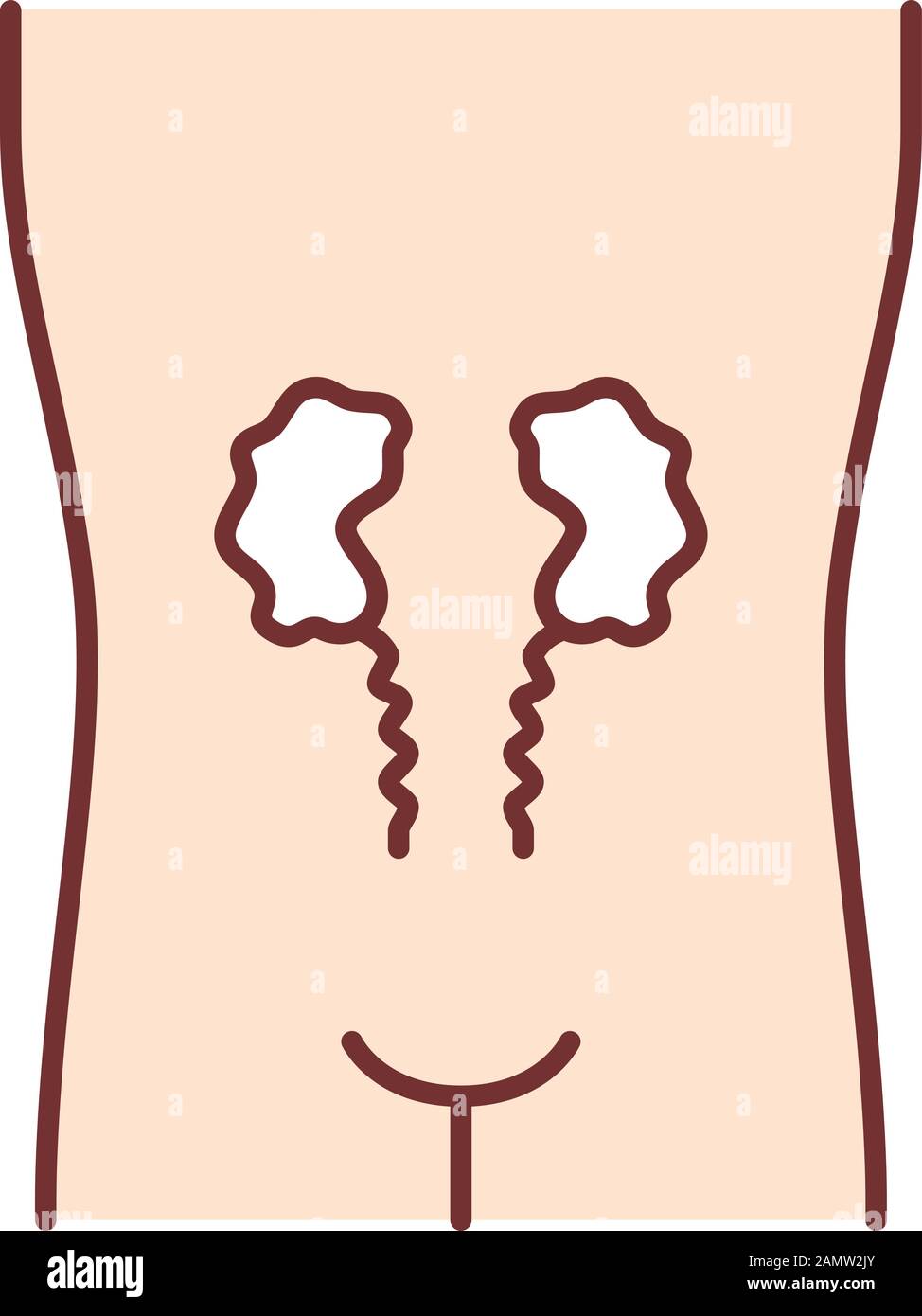 Ill kidneys color icon. Sore human organ. Unhealthy urinary system ...