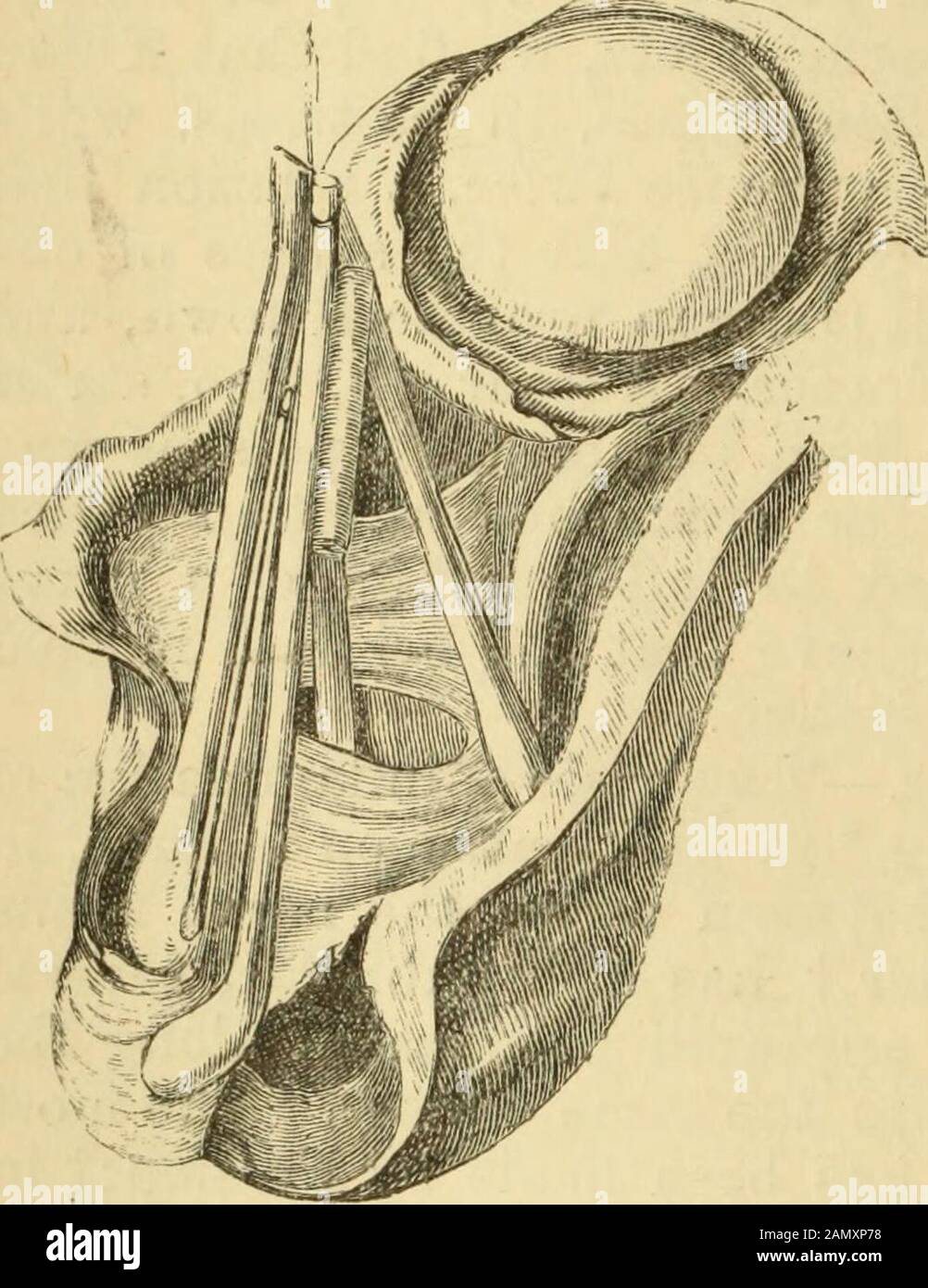 Bulbous anatomy hi-res stock photography and images - Alamy