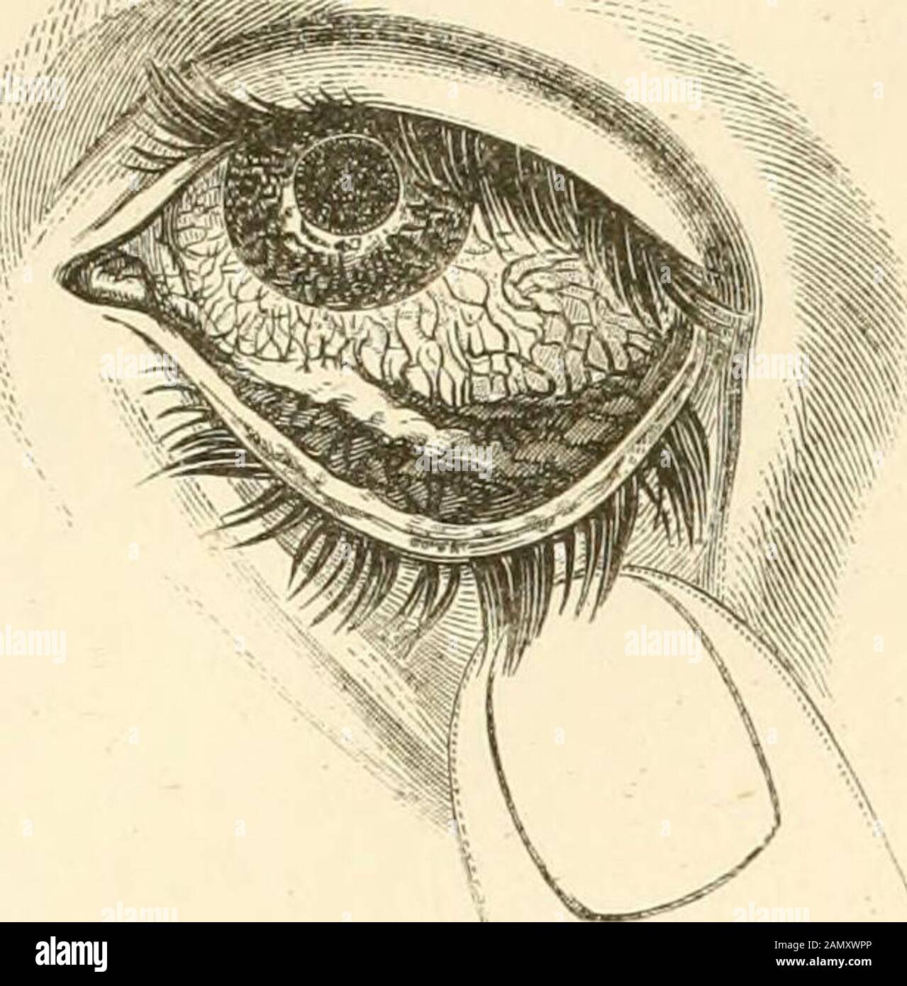 A treatise on the diseases of the eye . 51 DESCRIPTION OF PLATE X. Figs ...