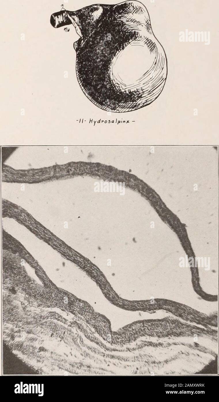 Microscopic drawing hi-res stock photography and images - Alamy